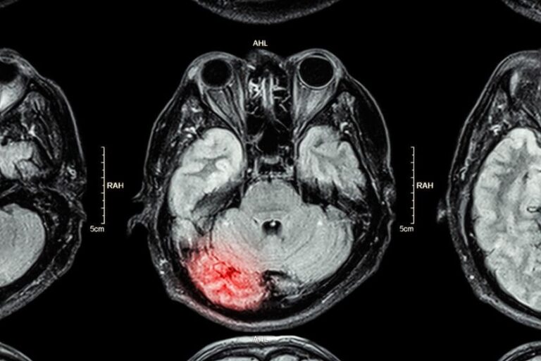 3 Types of MRI Machines and the Difference Between an Open MRI vs a ...