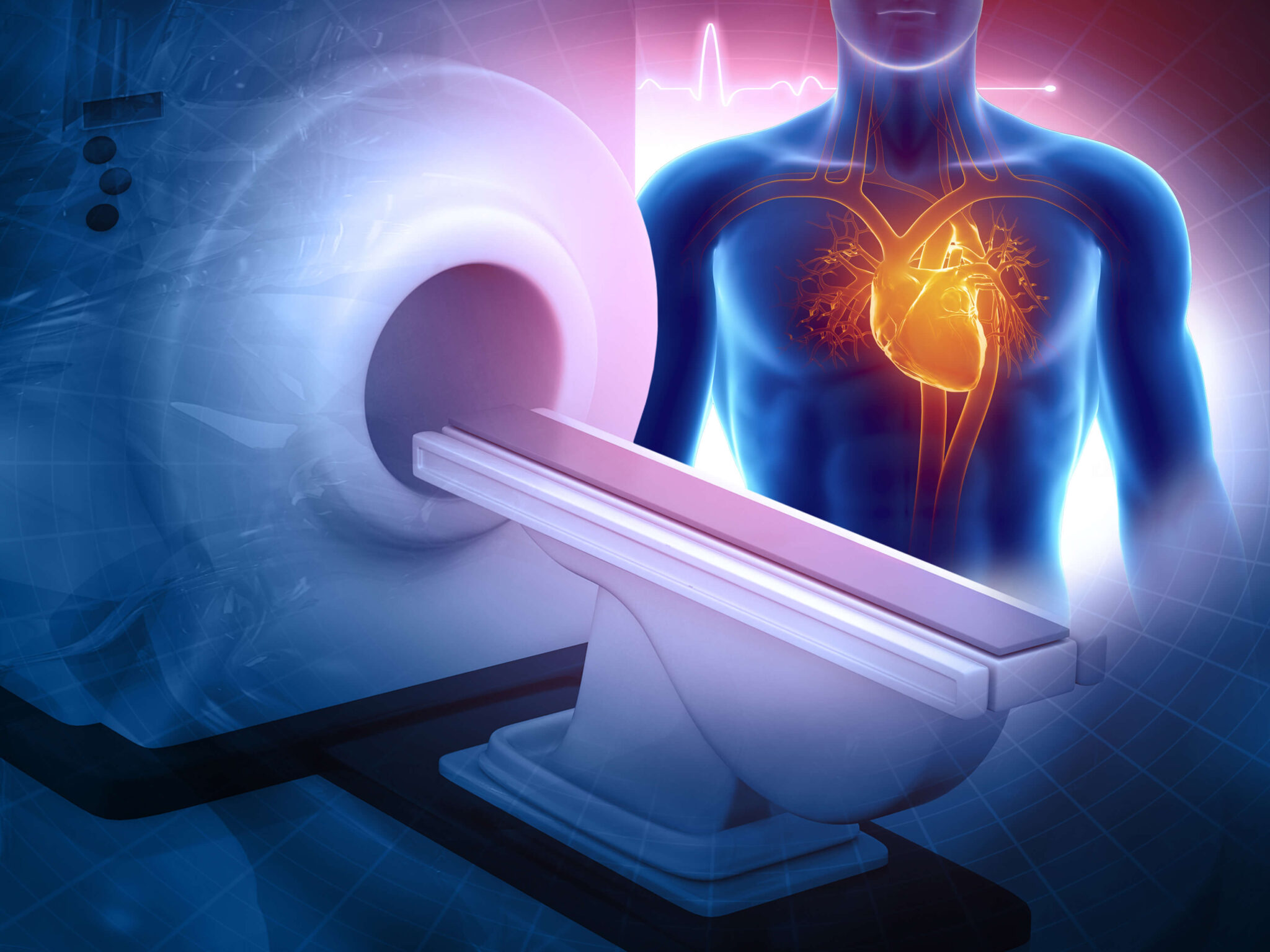 MRI as Good as Cardiac Catheterization for Diagnosing Coronary Heart ...